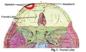 HEG Instruments - Biofeedback Institute of Los Angeles